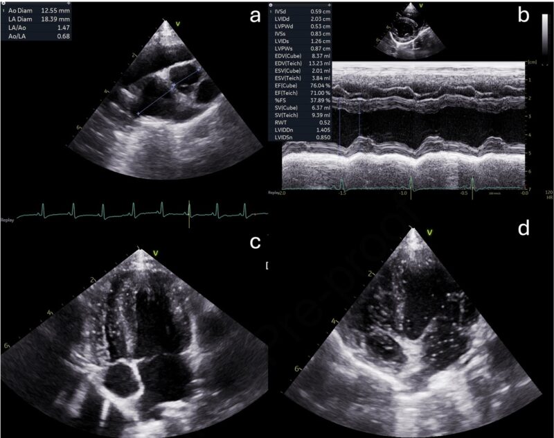 ‘bubble study 검사 개념 바꾸는 충격적 결과’, “정상 반려견 50~70% Shunt 있어” – 데일리벳